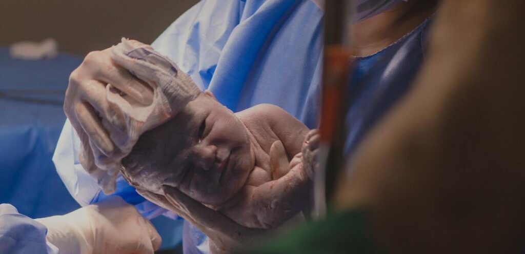 Il parto indotto: procedure, indicazioni e rischi - Santagostino Magazine