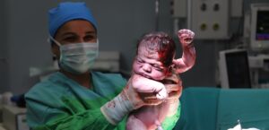 Il parto distocico o complicato: di cosa si tratta - Santagostino Magazine