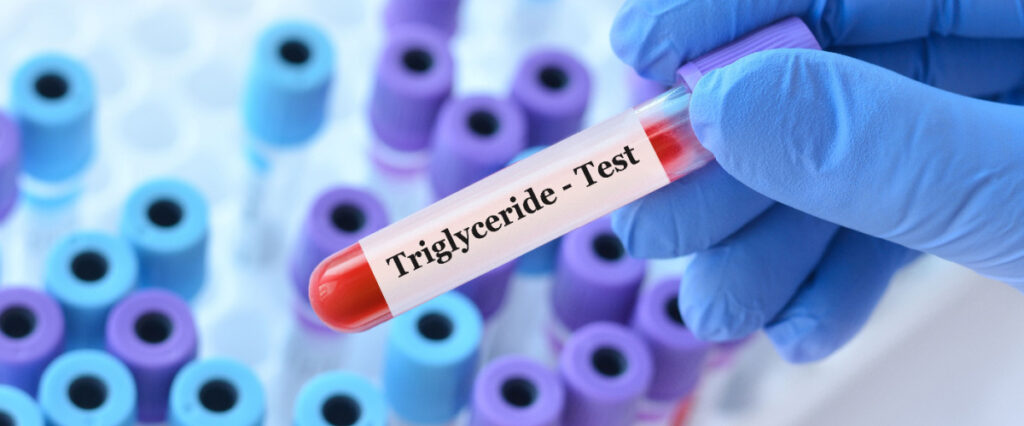 Come abbassare i trigliceridi? - Santagostino Magazine